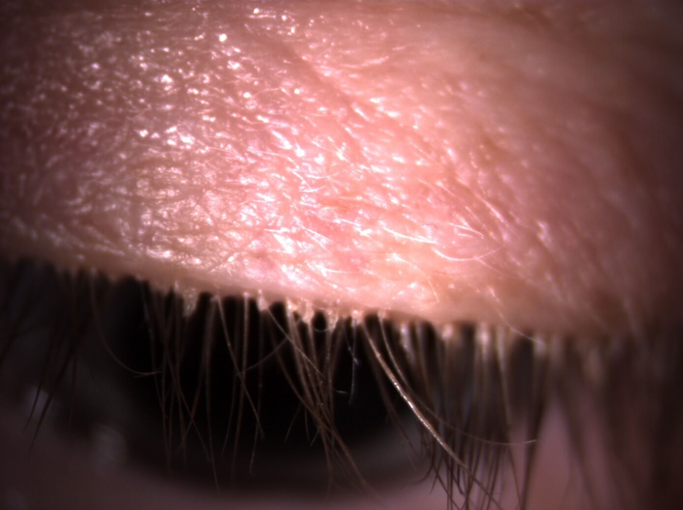 Look at the Lids for Collarette Detection | Look at the Lids